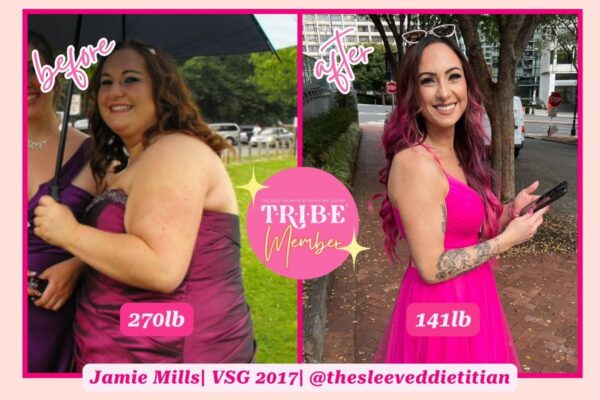 What Can You NEVER Eat Again After Gastric Bypass? - The Sleeved ...